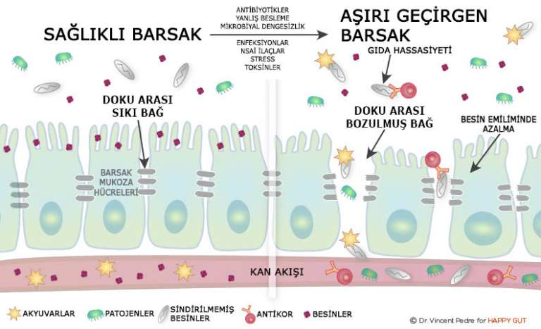 Aşırı Geçirgen Barsak Sendromu Ve Bütirik Asit | Axenic Agro